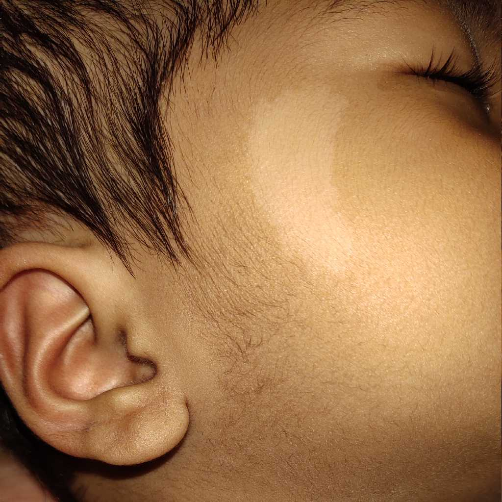 In my baby's mouth there some white color patches please look in to the ...