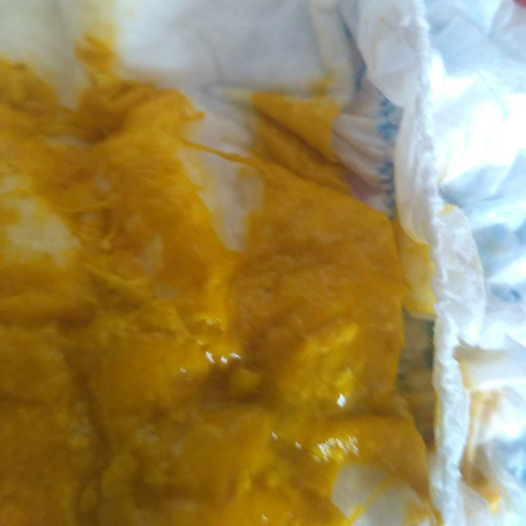 Hi Doctor, My Baby boy is 2 1/2 Month old, he is passing watery stool ...