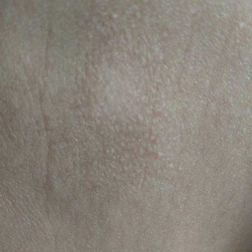 my baby is 4 months old but still he has spot and rashes on his skin ...