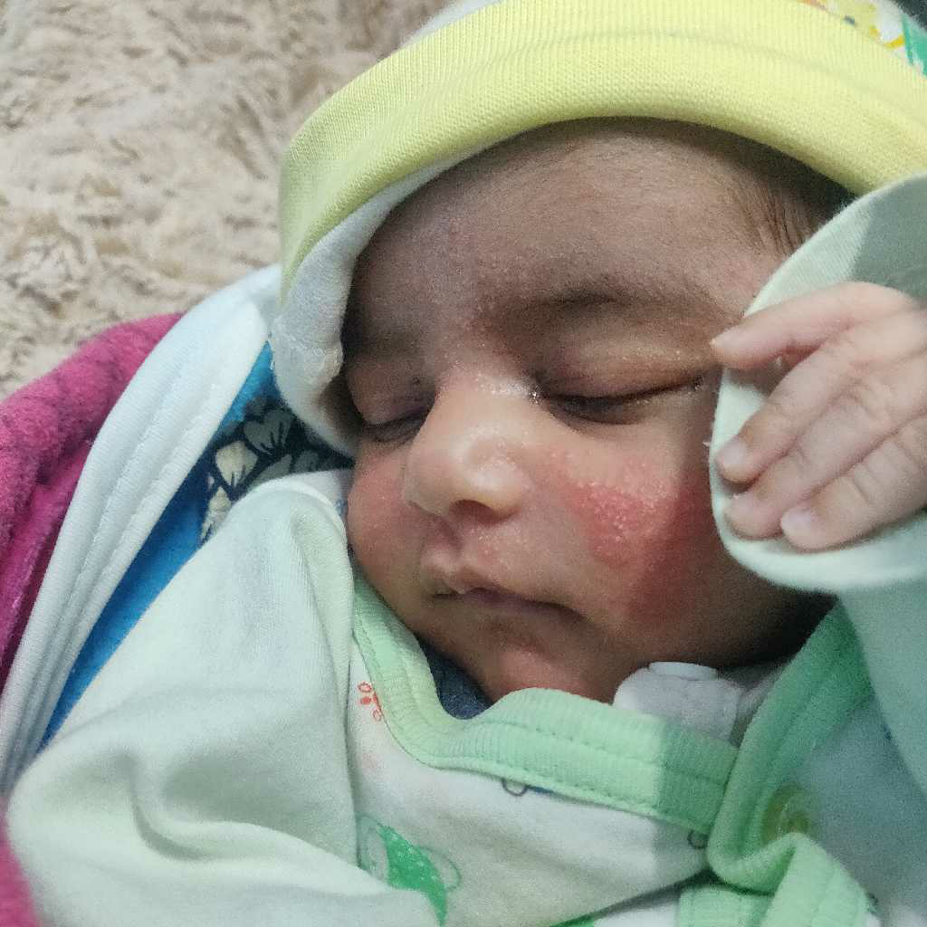 hello sir my daughter is having these kind of rashes could you suggest ...