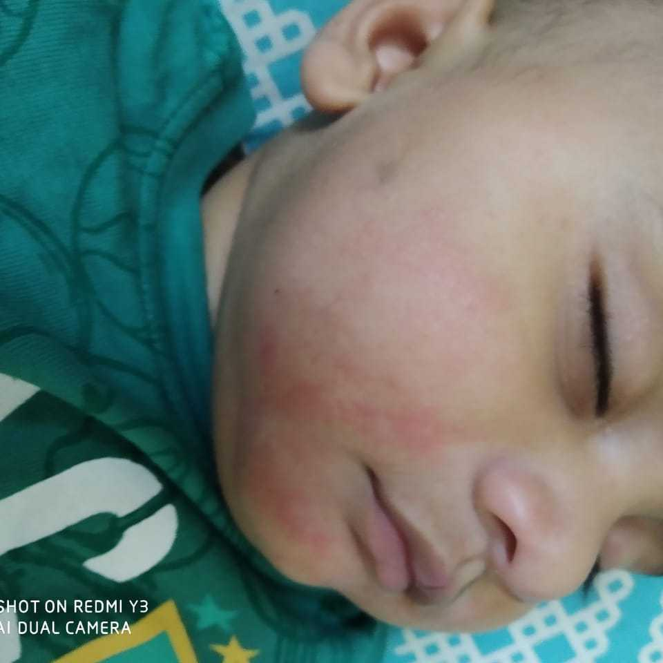 #ASKPaediatrician my baby skin became rough around neck area. what to ...