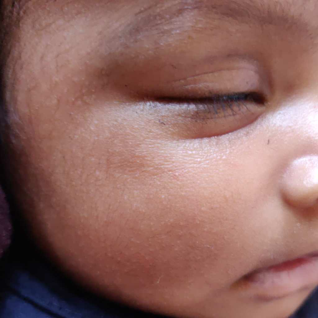 #ParentingClinic #BabySkinCare my baby is one month old he is getting ...