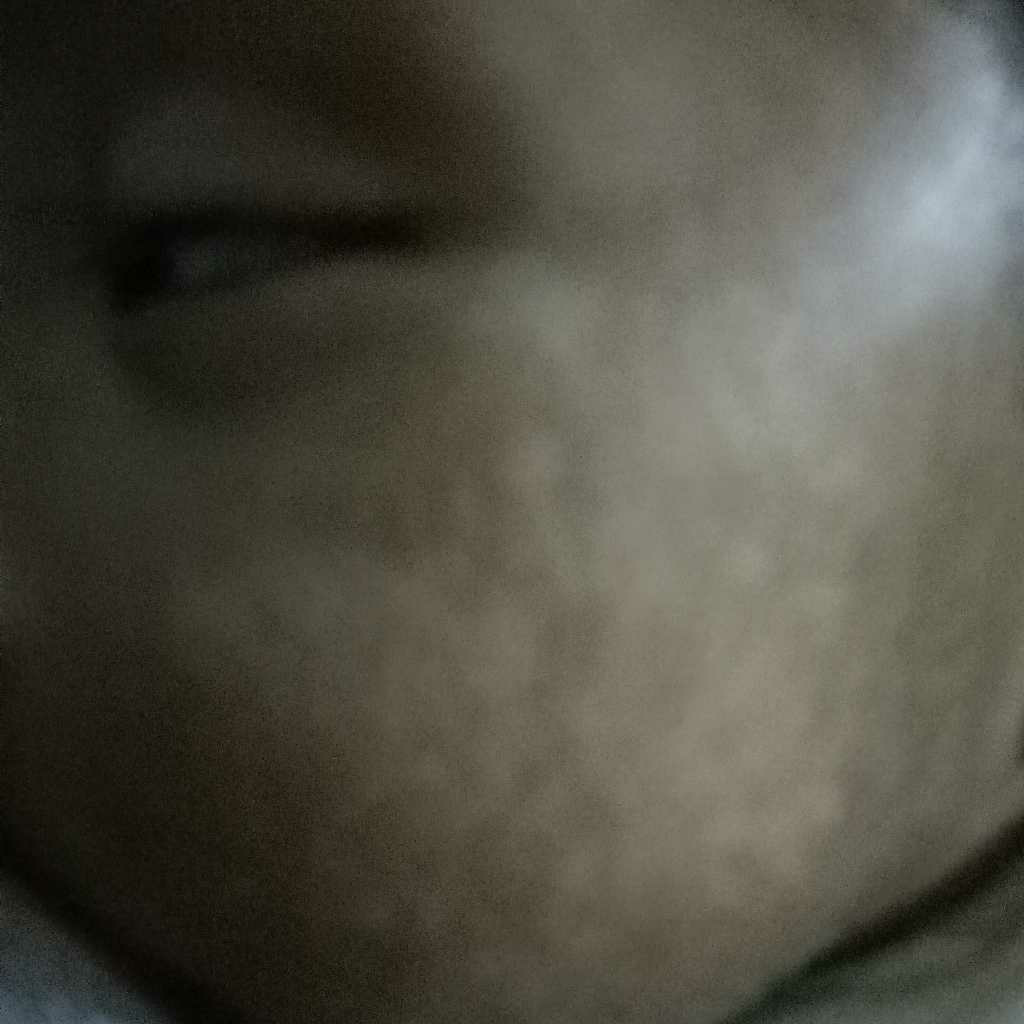 skin light color patch on face wat to do he is 50 day old – FirstCry ...