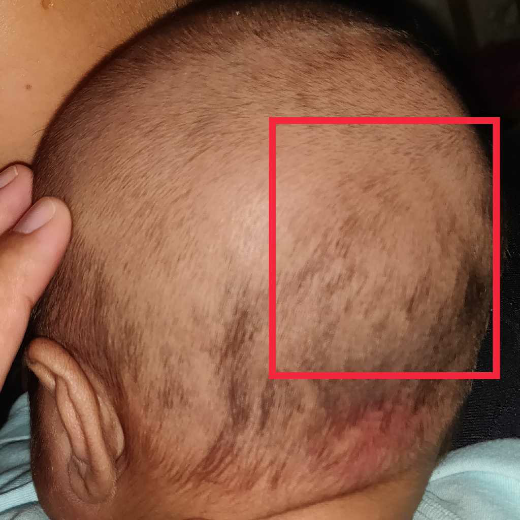 my baby get rashes on neck...pls suggest any remdy for this....pic is ...