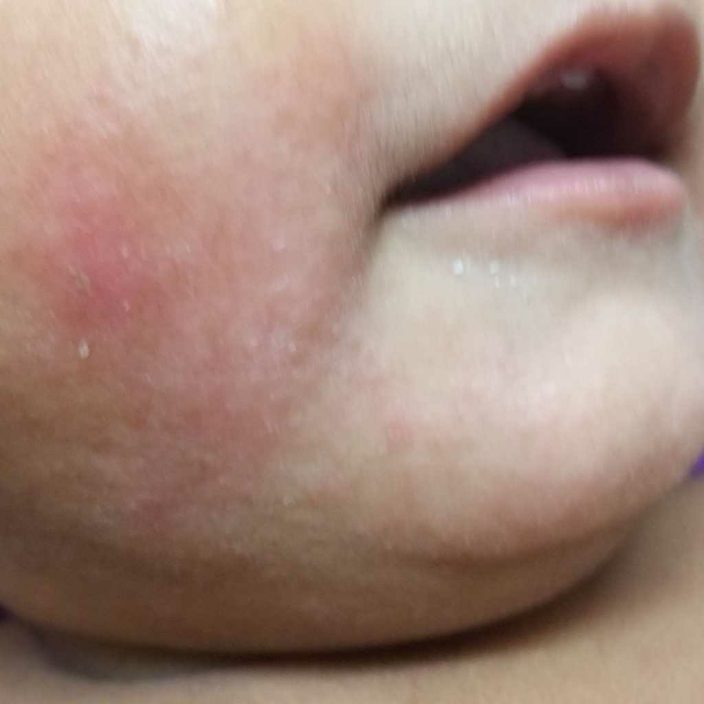 Hello, my son is 8 months old and from few days back I m observing ...