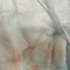 my baby boy is 3months old since 2daya when he passes urine I find ...