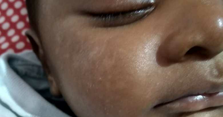 #ParentingClinic #BabySkinCare Please provide the solution for thease ...