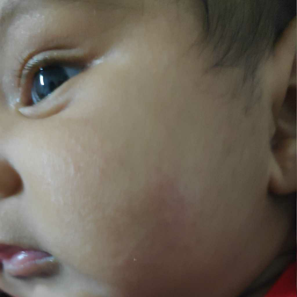 8 months baby have red spots on back side head kindly suggest ...