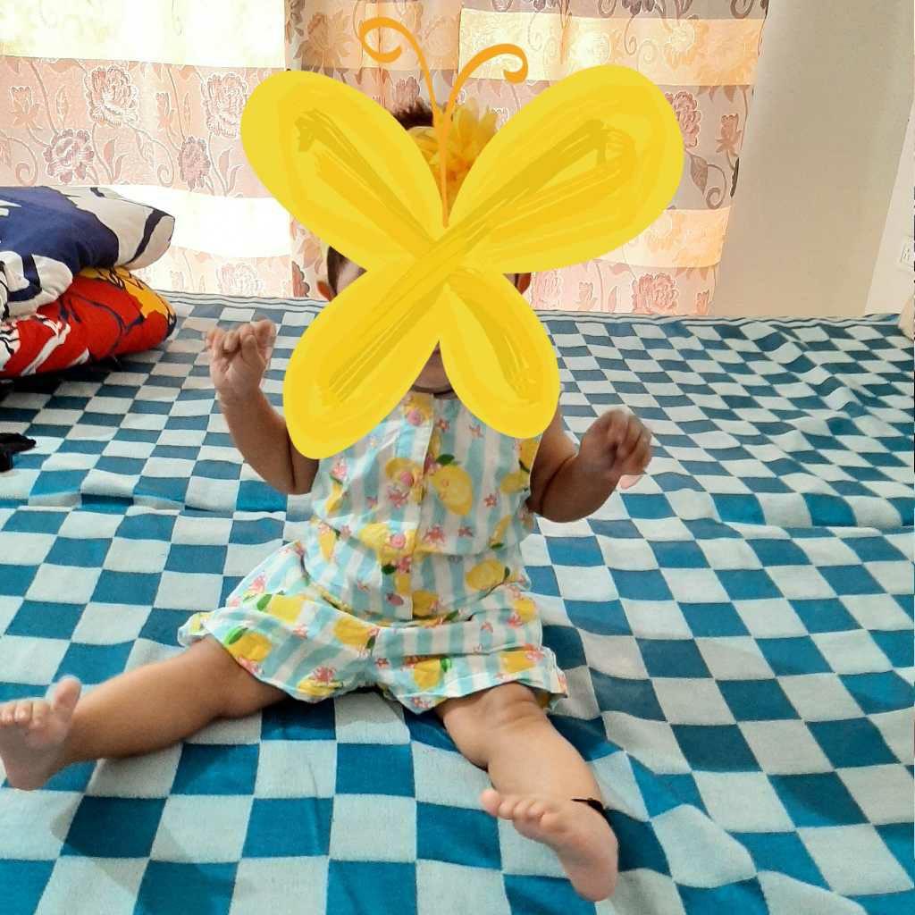 My 4 month so baby's feet of one leg is slightly bended inwards from ...
