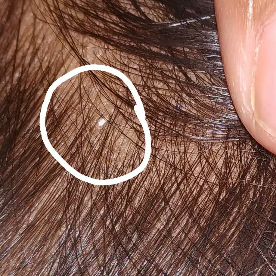 #AskTheExpert My baby is 2.5 month old... today I have seen a small ...