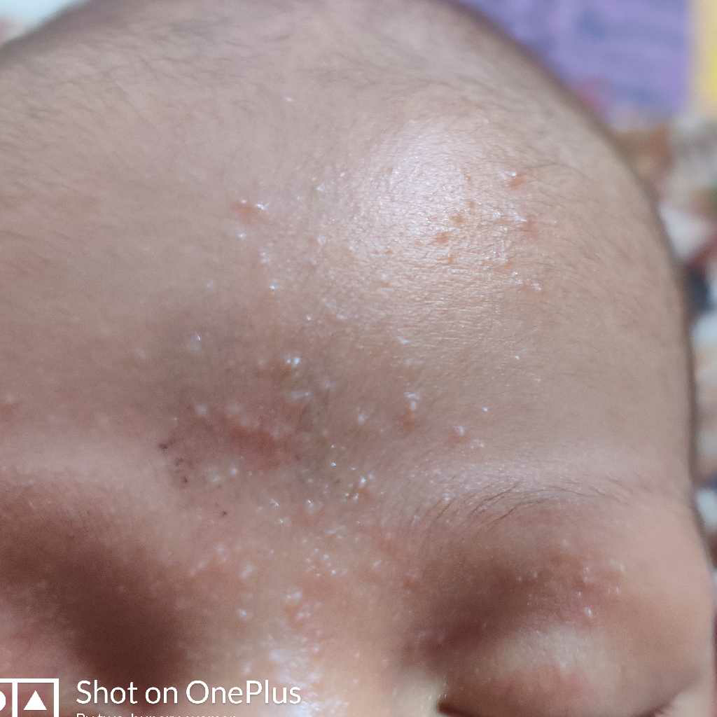 My baby boy is 6 Months & 10 days old. From around last one month, my ...