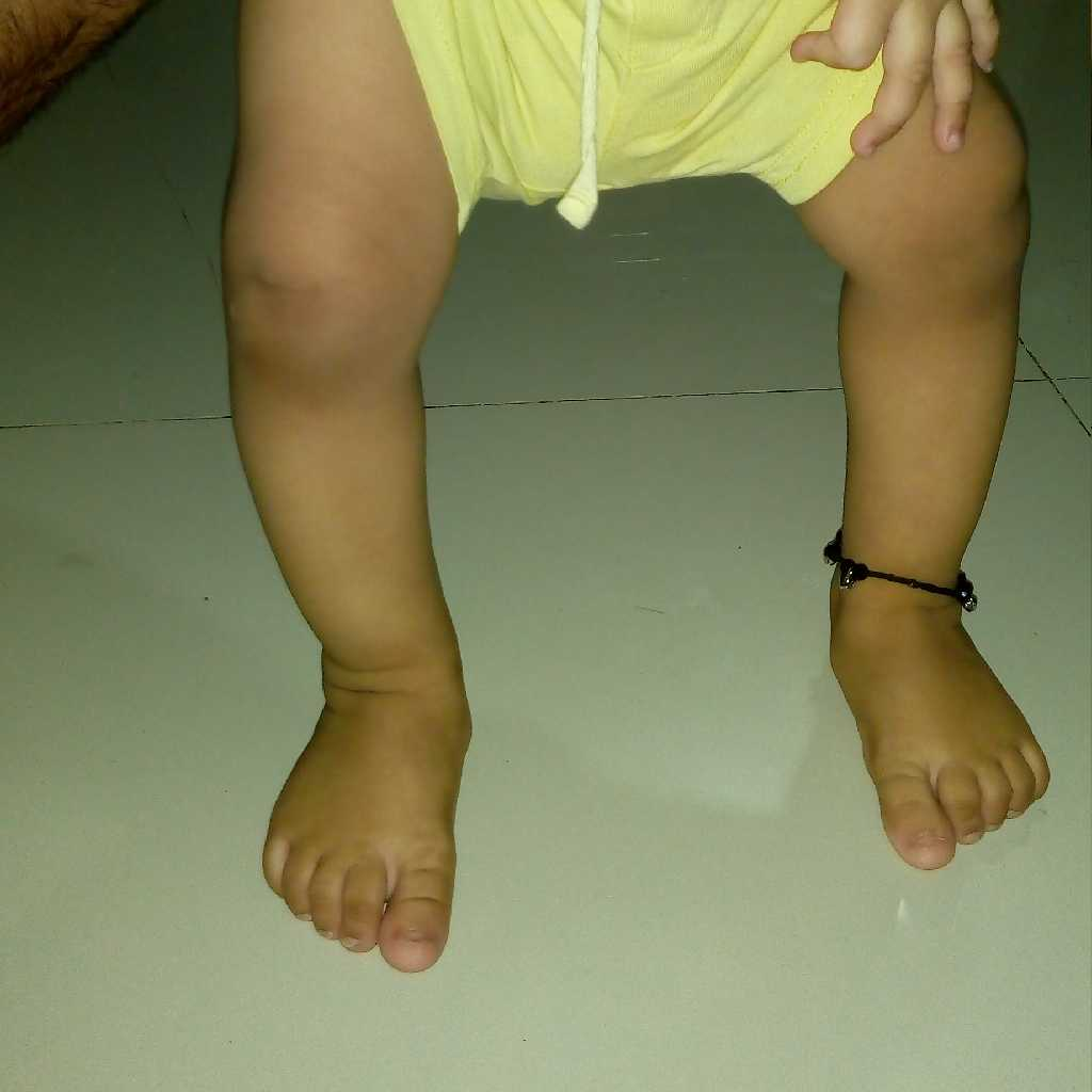 #AskTheExpert Hi doctor.. I am a mother of 50 days old baby.. In my ...