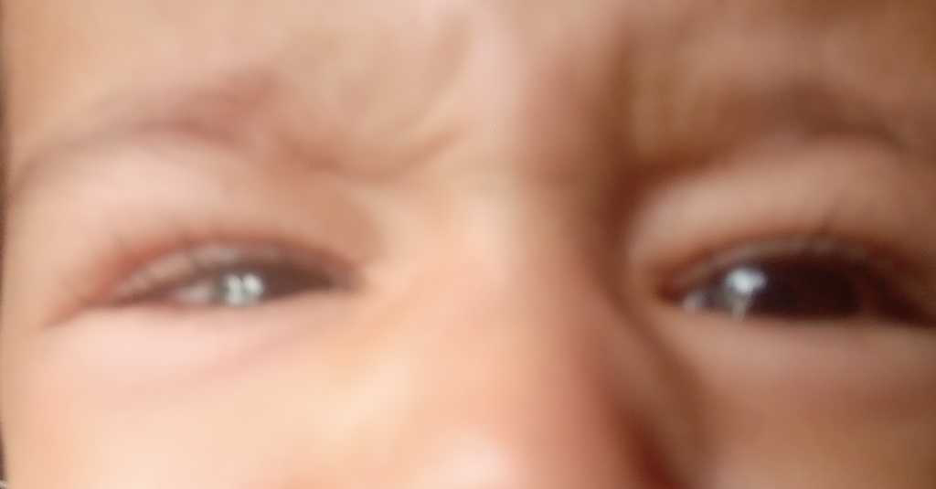 sir my daughter having etching on eyes. since. seven days. and here ...