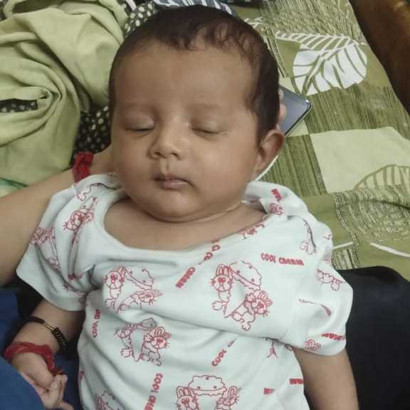 hi my baby was born with fair skintone but after 10 days he turned dark ...