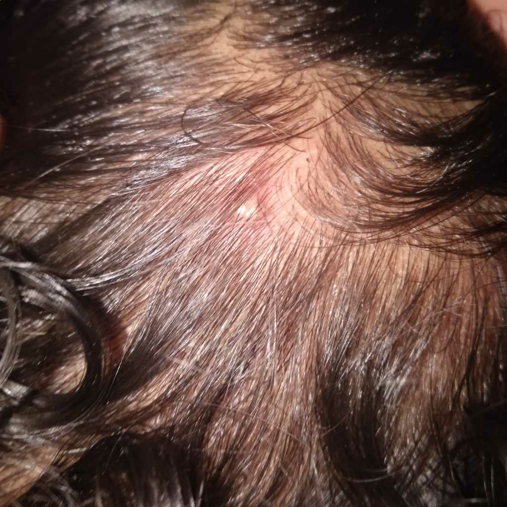 #ASKPaediatrician hello doctor my baby 1year 5month old just now we see ...