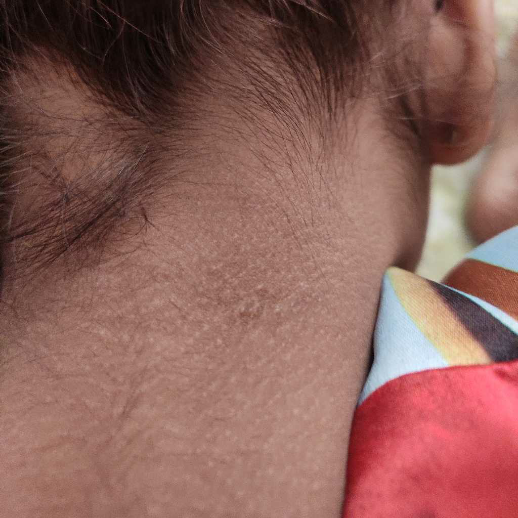 sir ,girl is 6 years old .she is feeling some itching on her hands and ...