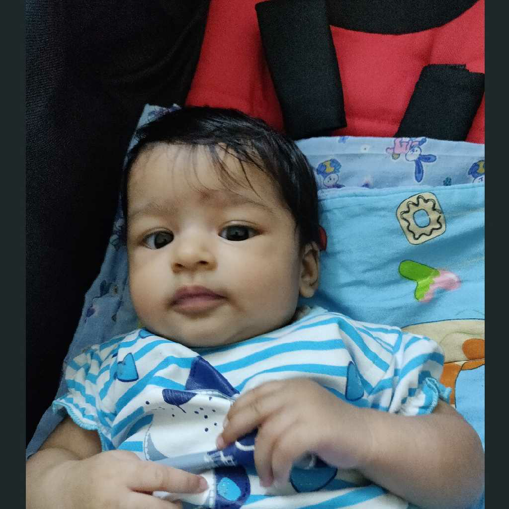 #AskTheExpert Hello.. I can see slight squint in baby eye. pls suggest ...