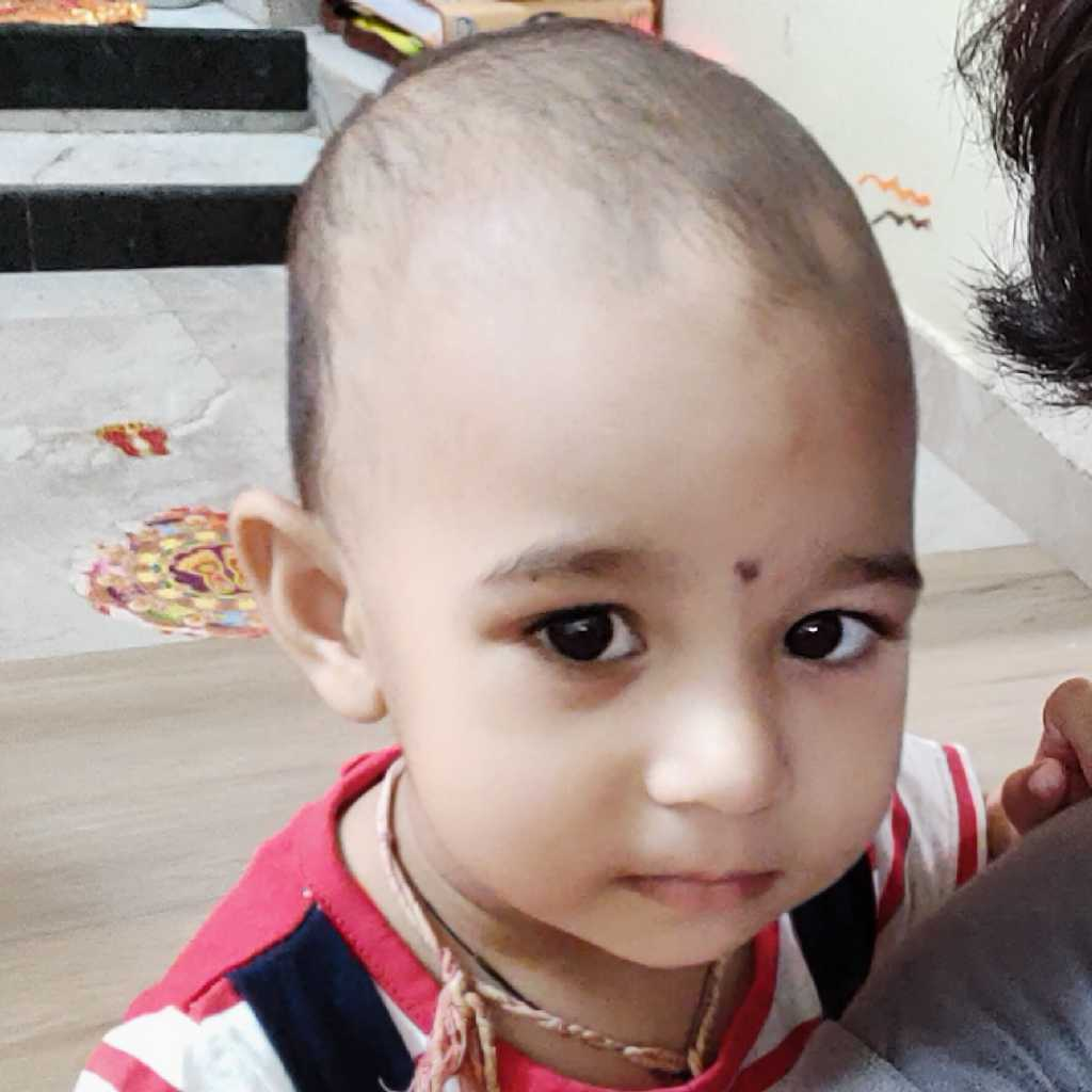 the frontal lobe of the baby's head where palpitation is showing little ...