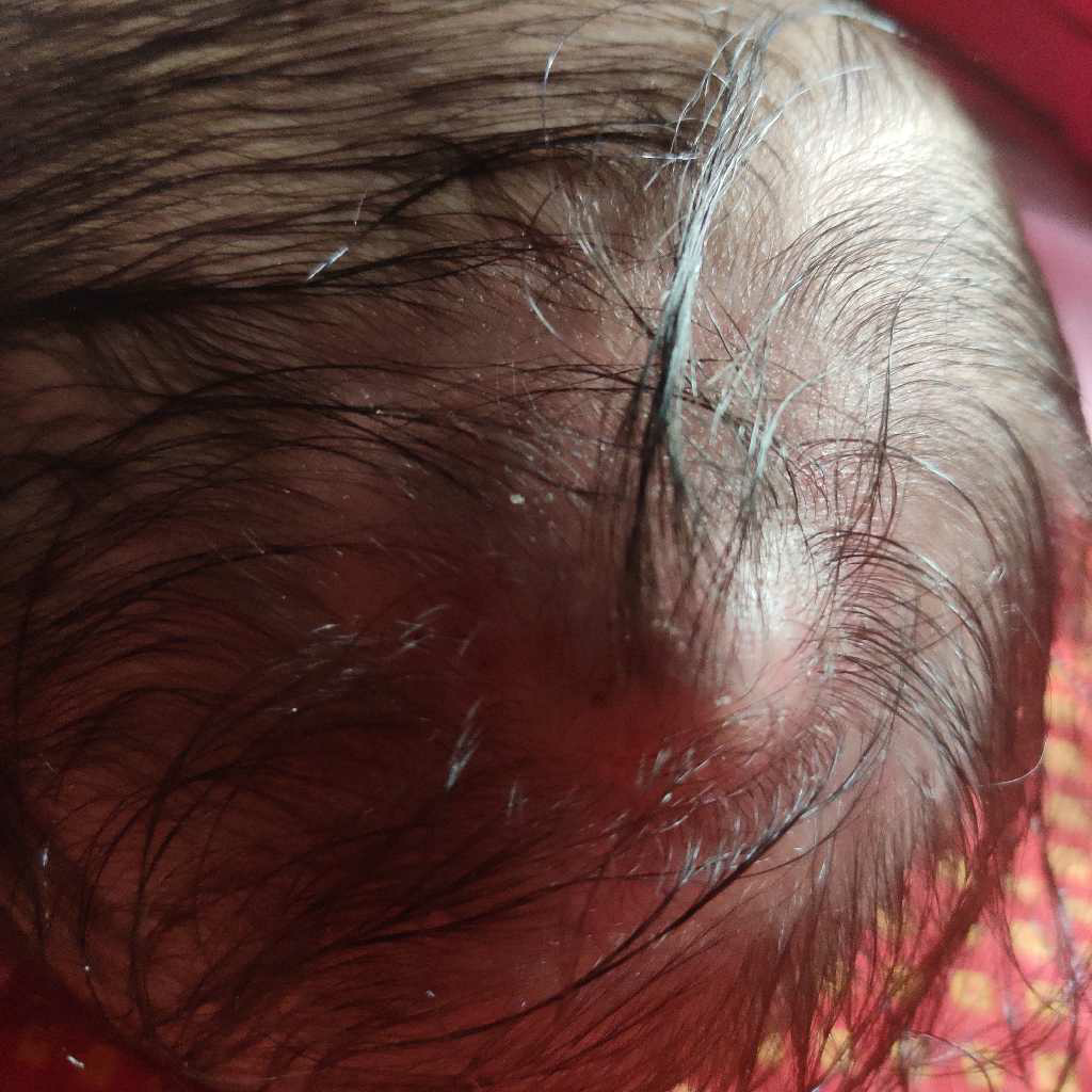 hello, doctor my son is 2:5 year old actually i saw back side of head ...