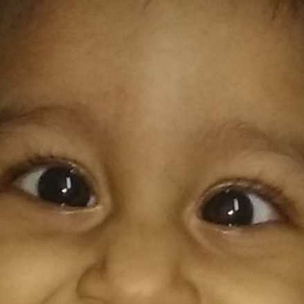 my baby is 3 months old, sometimes we are observing that both the ...