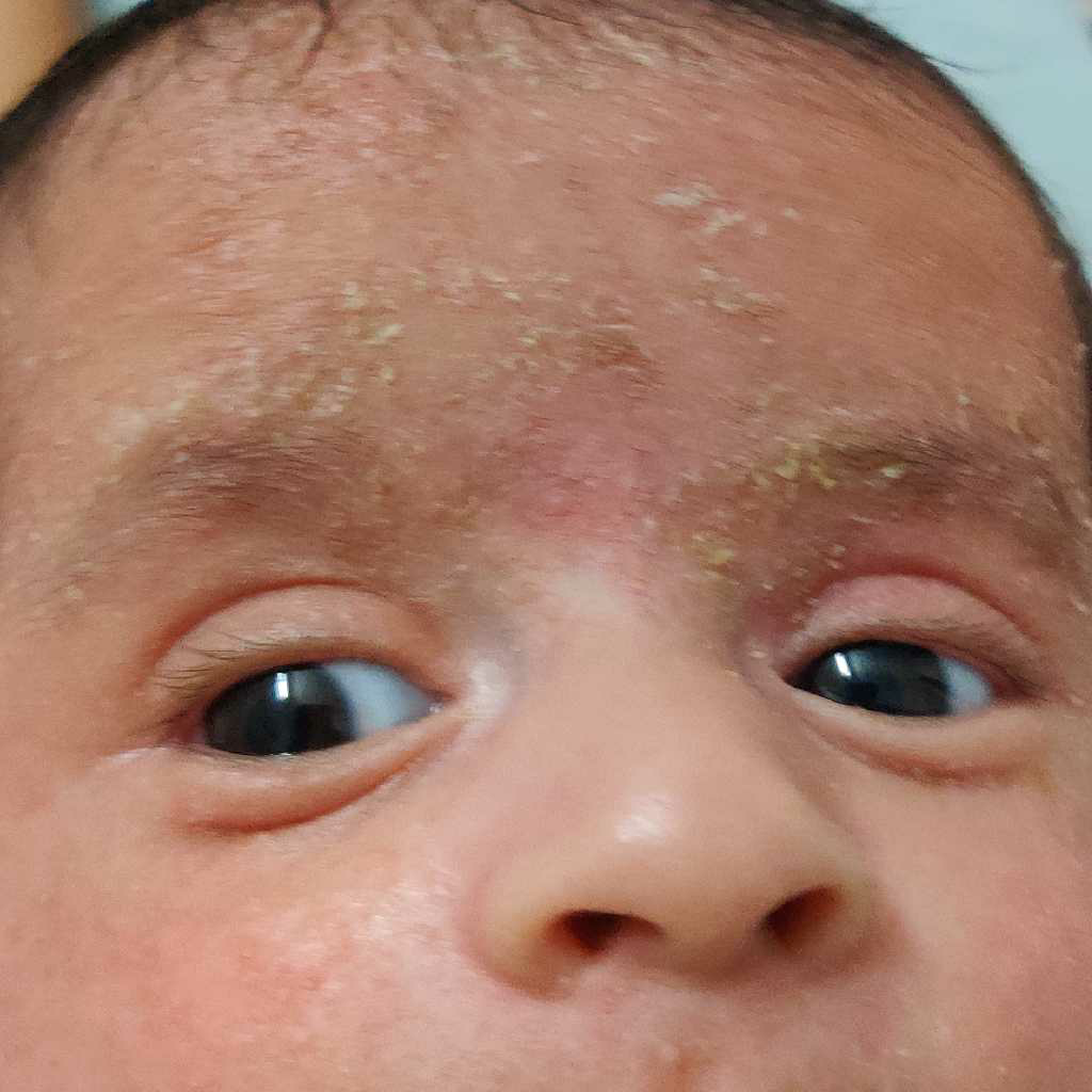 My girl is 7 weeks ..she have dandruff kinda particles when I rub her ...