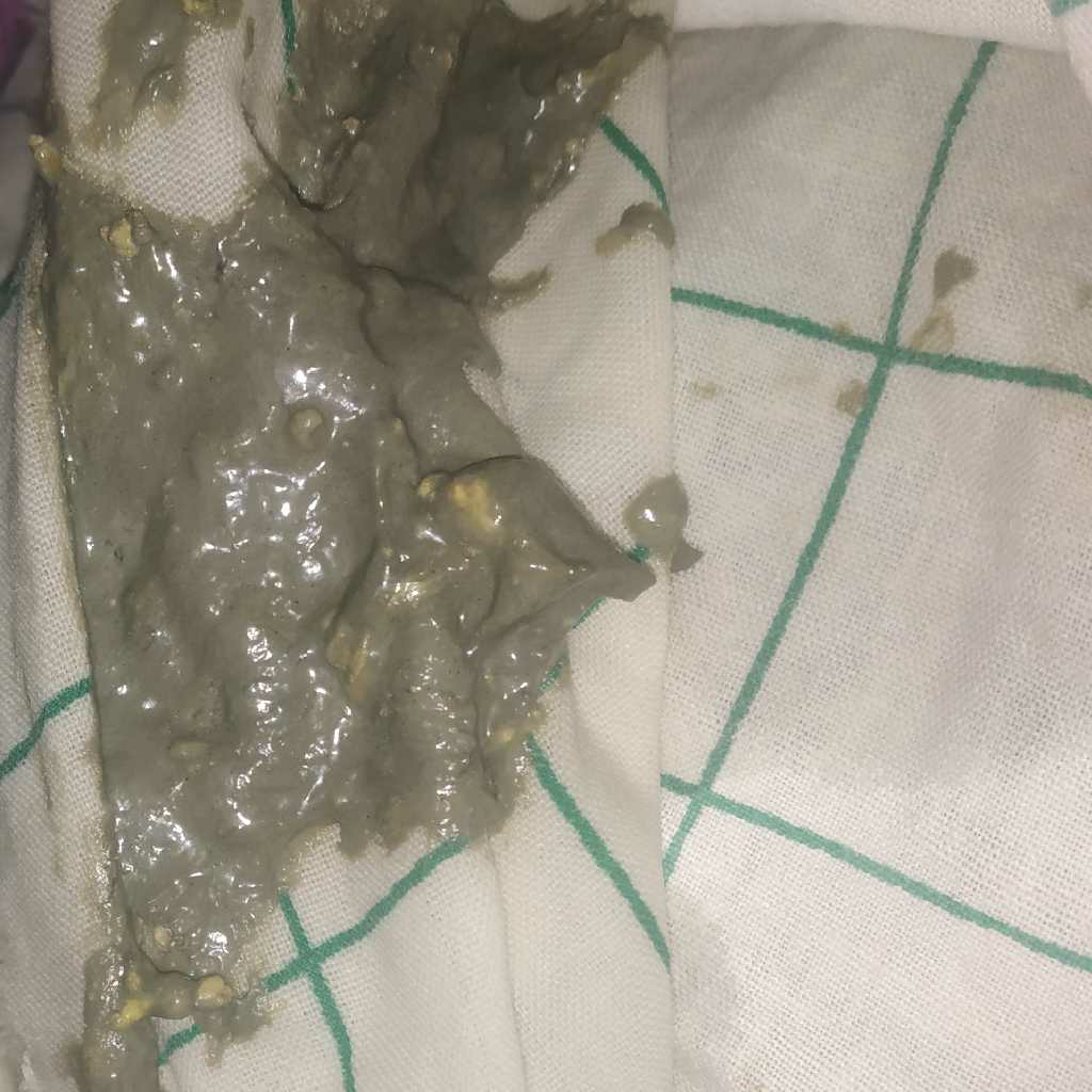 my baby is 47days old... her poop is grey in colour... she is formula ...