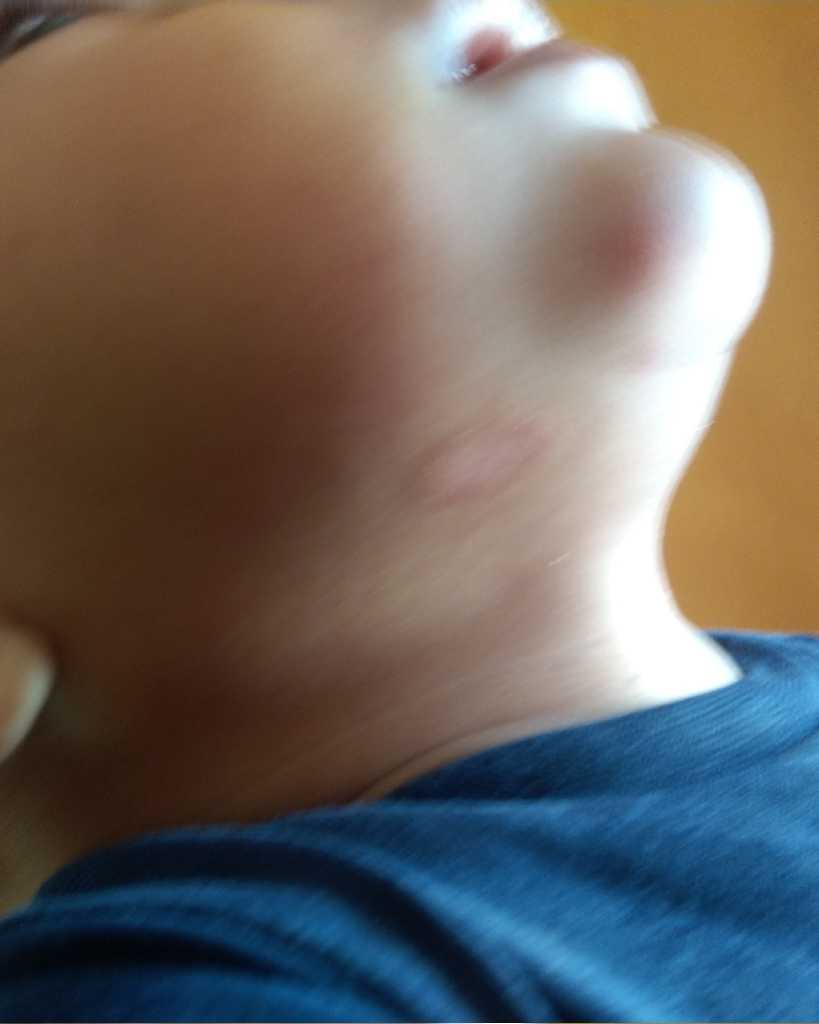 hi my 7 month old son have Ringworm on his face above the neck could ...